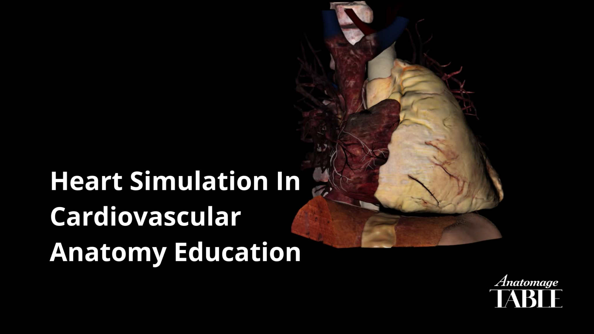 Heart simulation in cardiovascular anatomy teaching