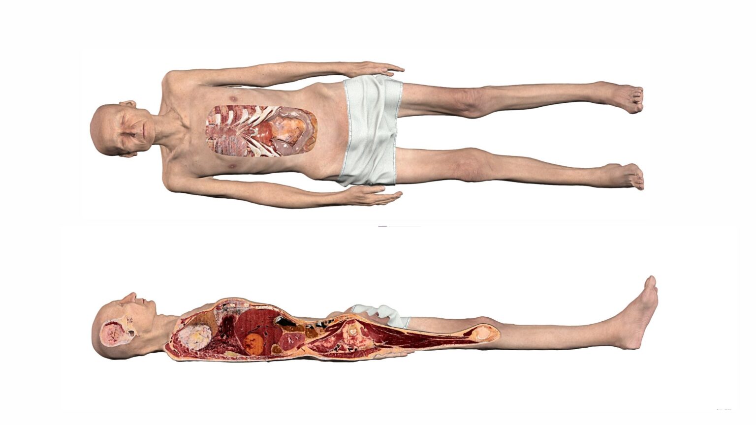 About Us - Anatomage